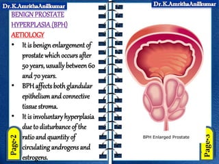 Beningn prostrate Hypertrophy (BPH) by Dr.K.AmrithaAnilkumar | PPT