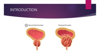 Bph.pptx