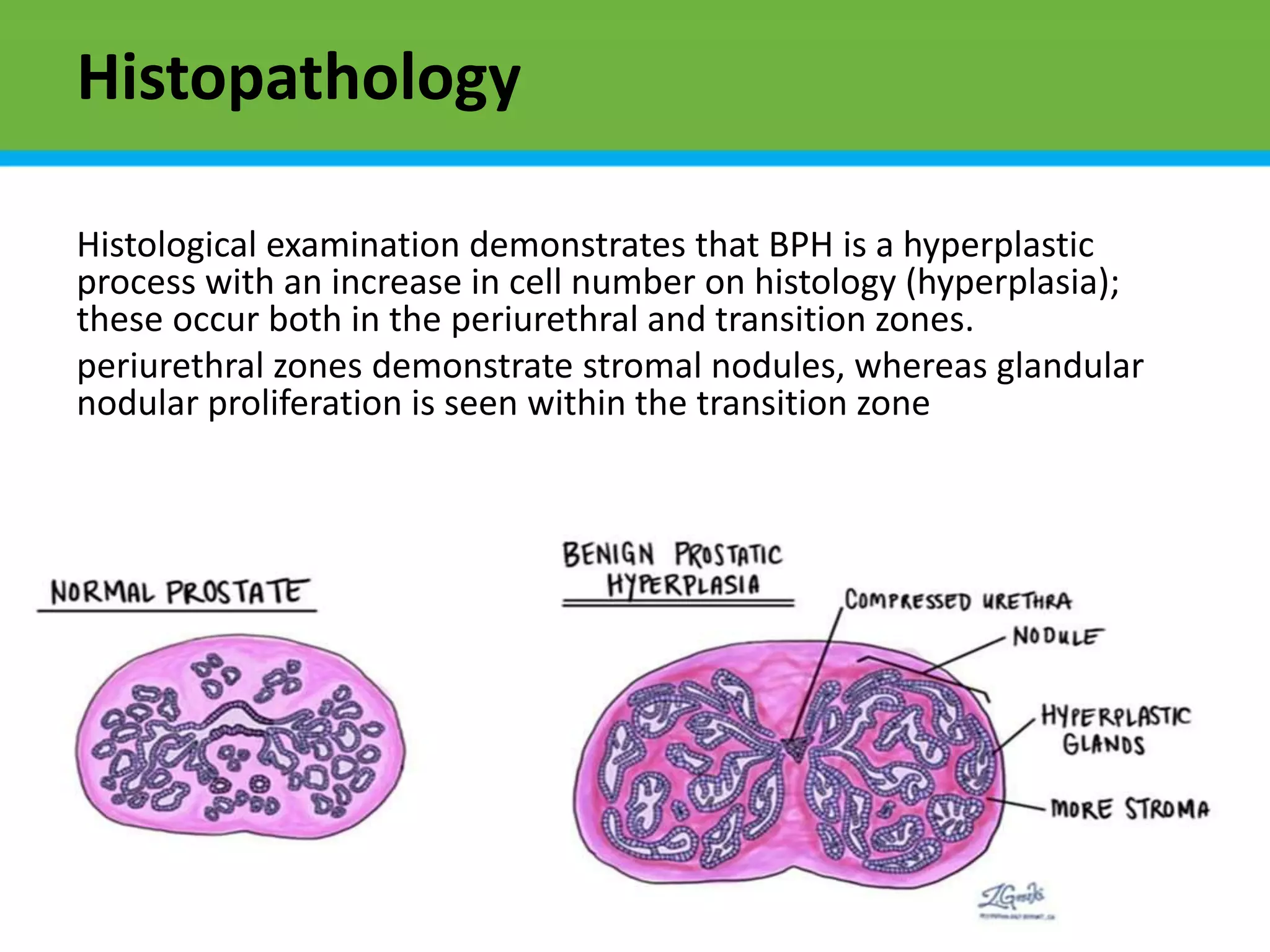 bph.pptx