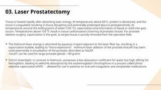 BPH (benign prostatic hyperplasia) in urology | PPTX