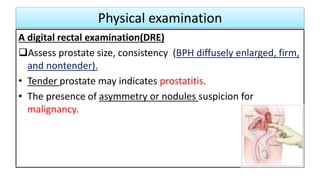 benign prostatic hyperplasia by dr.bagasi | PPT