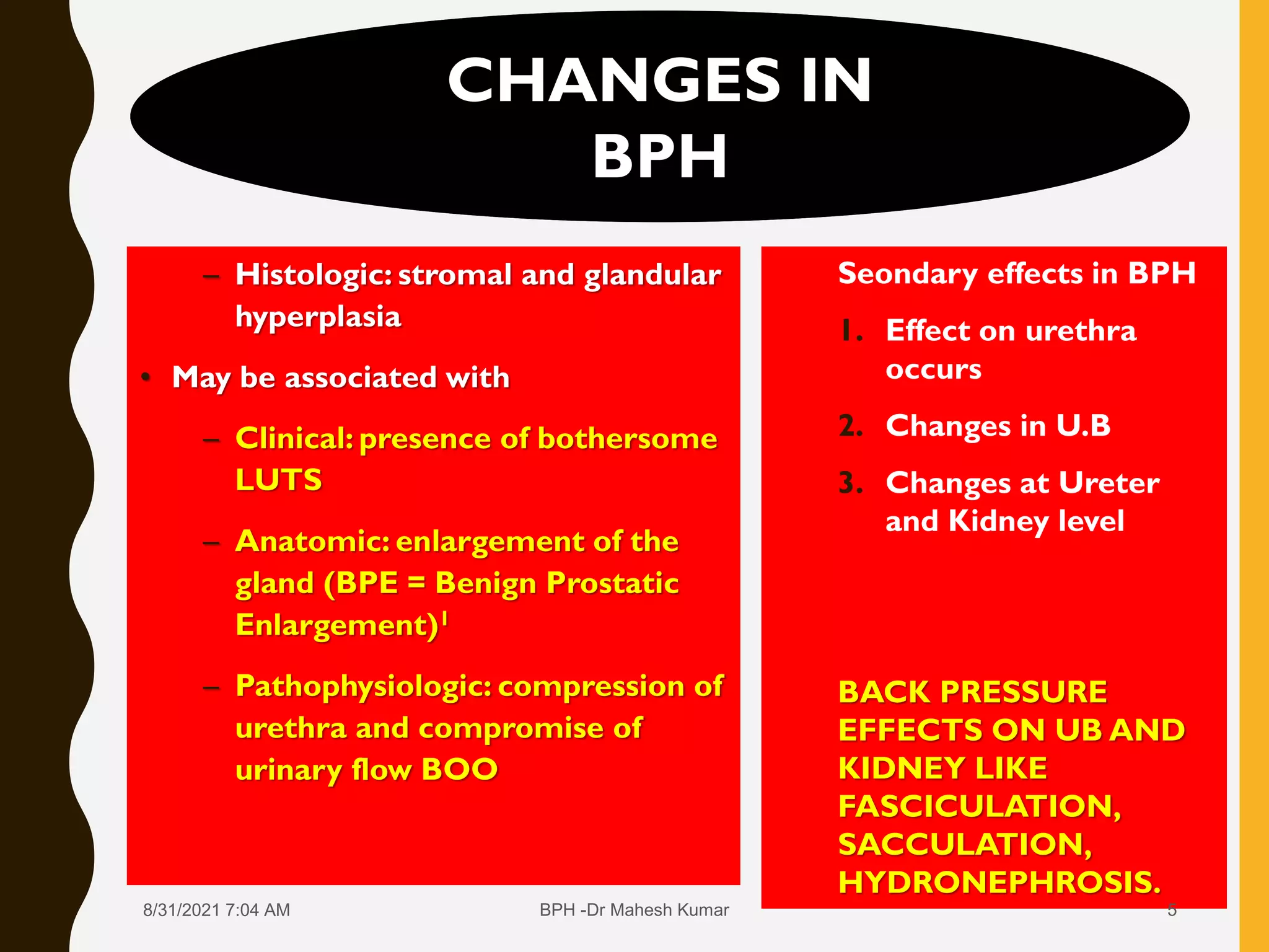 BPH#Benign Prostate Hyperplasia#Benign Prostate enlargement#BPE# ...
