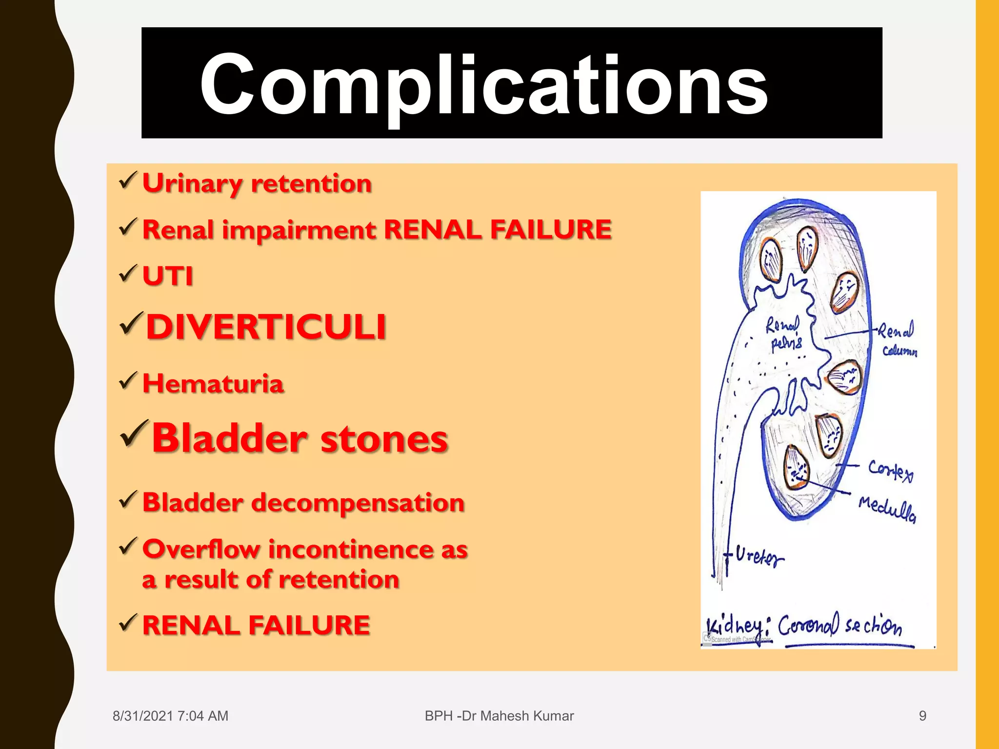 BPH#Benign Prostate Hyperplasia#Benign Prostate enlargement#BPE# ...