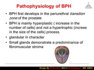 BPH | PDF