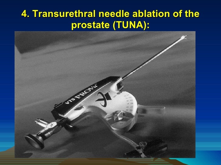 Urology 5th year, 1st lecture (Dr. Sarwar)