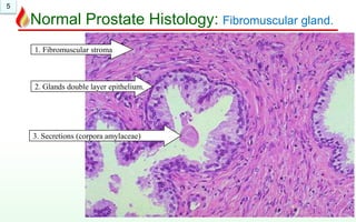 Pathology of Prostate - Benign | PPTX