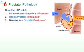 Pathology of Prostate - Benign | PPTX