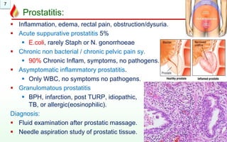 Pathology of Prostate - Benign | PPTX