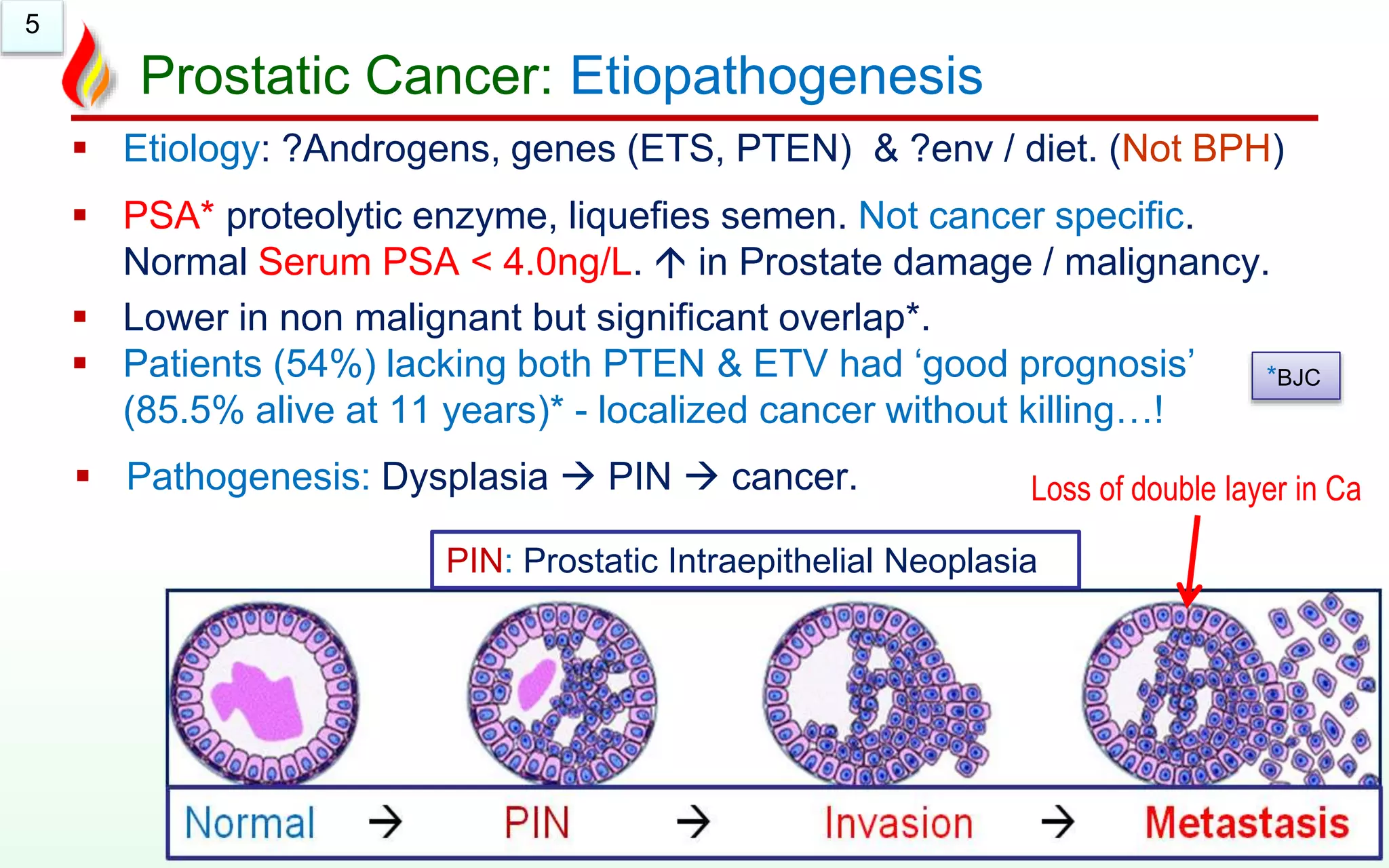 Pathology of Prostate - Cancer | PPT