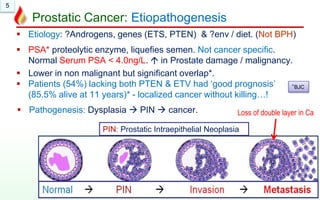 Pathology of Prostate - Cancer | PPTX