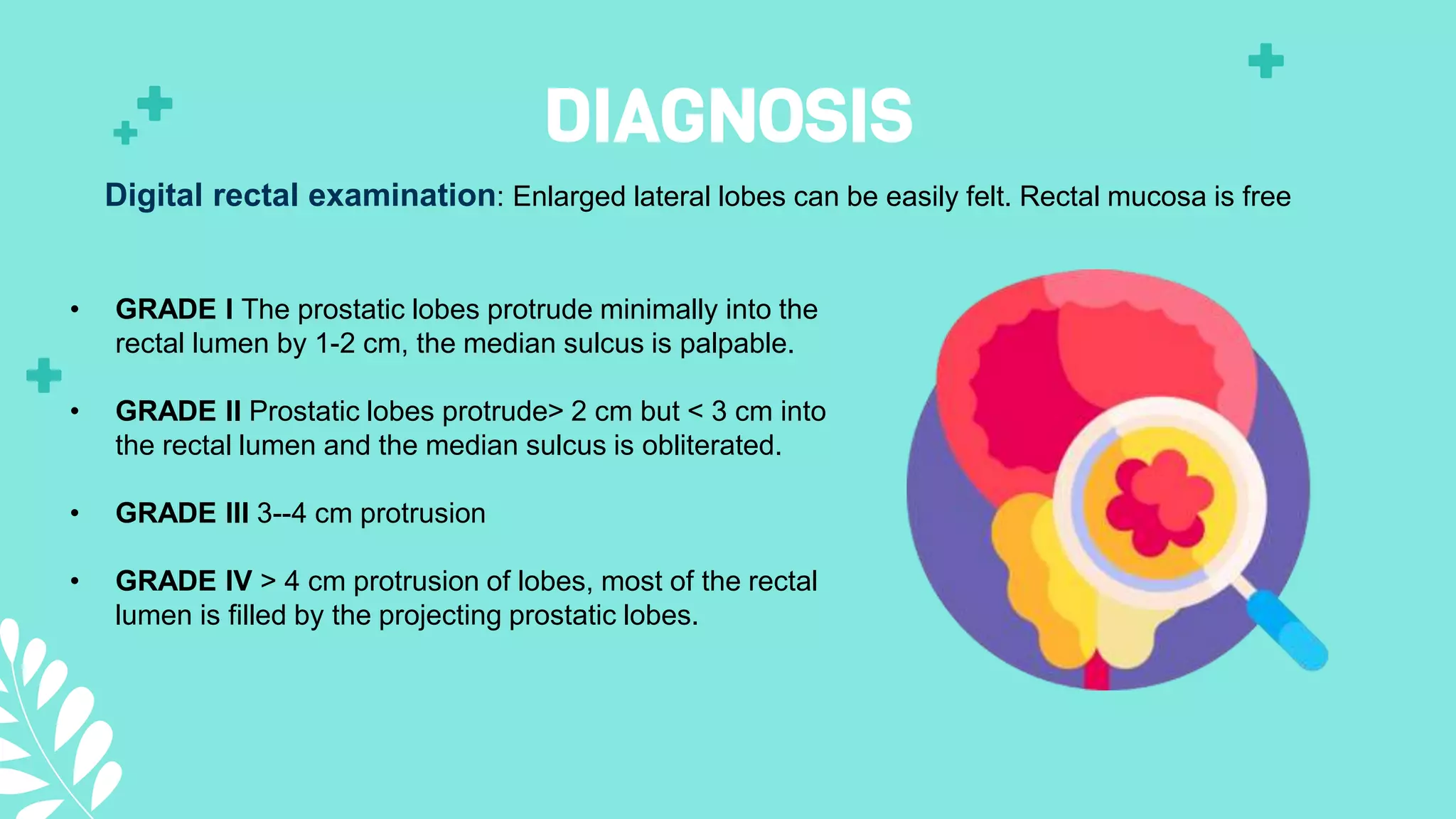 benign prostatic hyperplasia and carcinoma.pptx