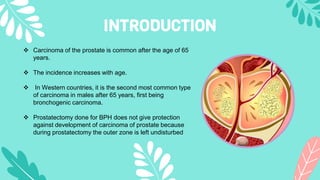 benign prostatic hyperplasia and carcinoma.pptx