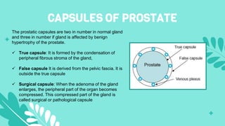 benign prostatic hyperplasia and carcinoma.pptx