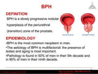 BPH and Obstructive Uropathy | PPT