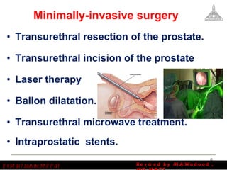 BPH and Obstructive Uropathy | PPT