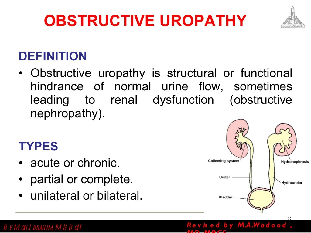 BPH and obstructive uropathy
