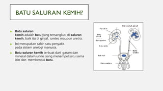 BPH dan BSK (Batu Saluran Kencing).pptx. | PPT