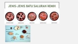 BPH dan BSK (Batu Saluran Kencing).pptx. | PPT