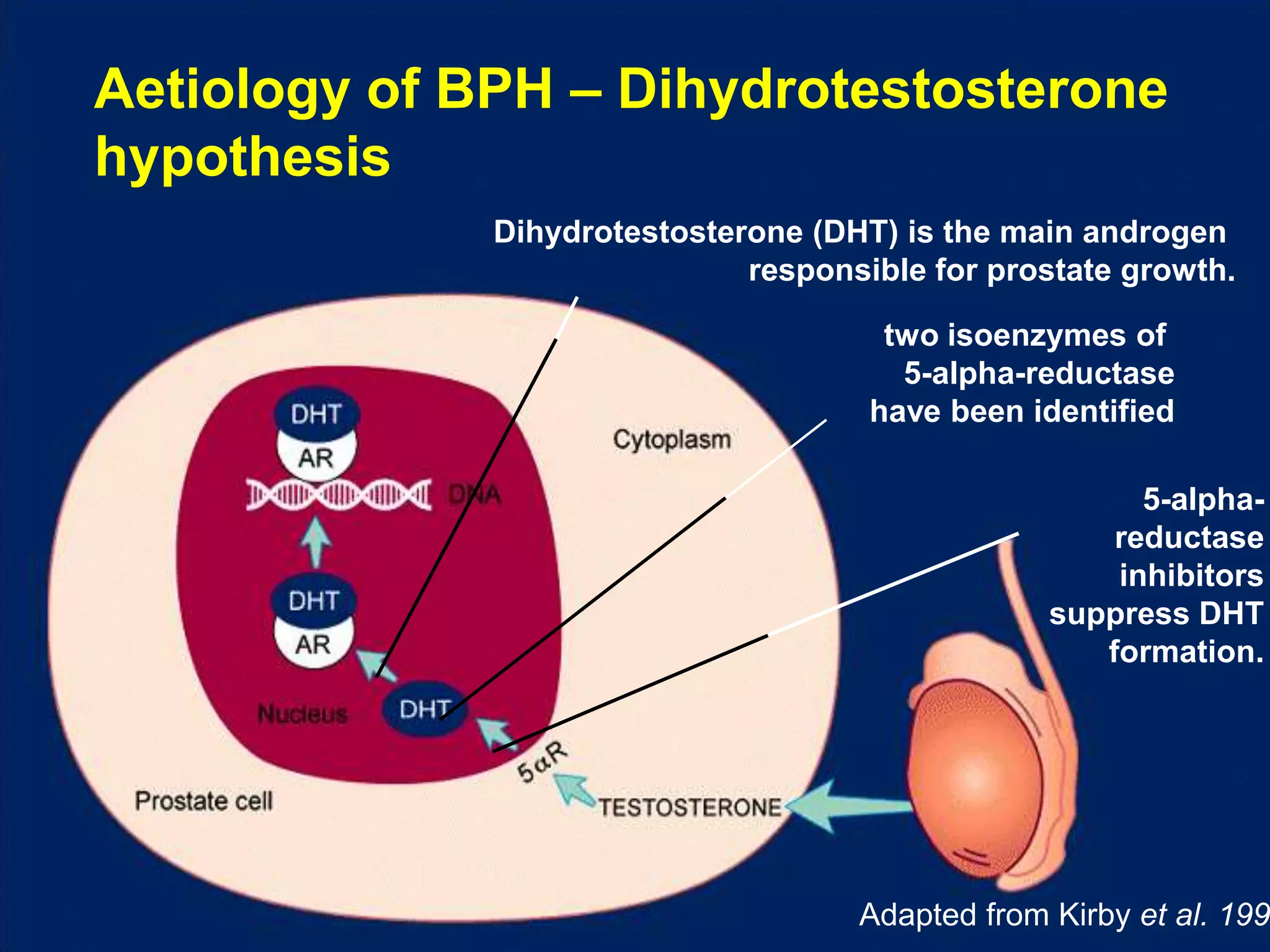 Benign prostatic hyperplasia by Sayed Eleweedy | PPT