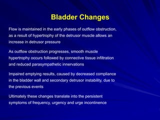 Benign prostatic hyperplasia by Sayed Eleweedy | PPT