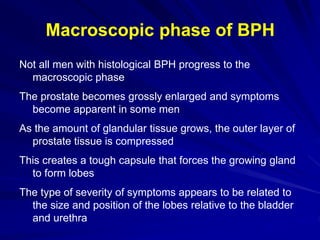 Benign prostatic hyperplasia by Sayed Eleweedy | PPT