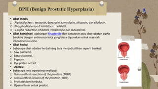 BPH KELOMPOK 1.pptx