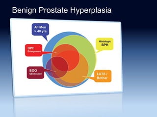 Etiology of BPH | PPTX