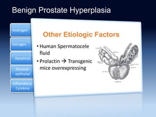 Etiology of BPH | PPTX