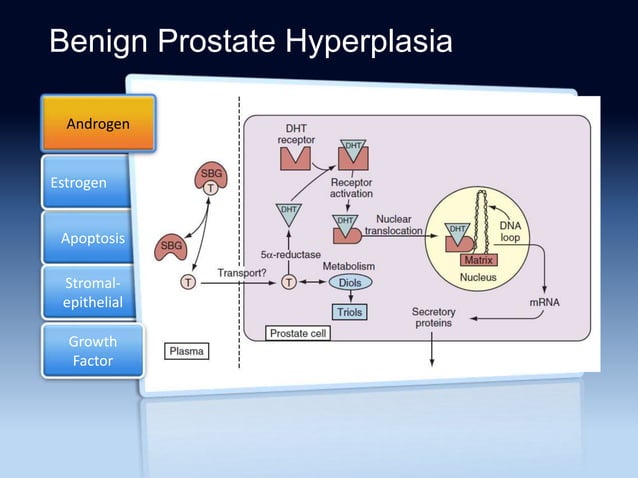 Etiology of BPH | PPTX