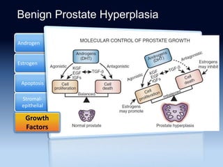 Etiology of BPH | PPT