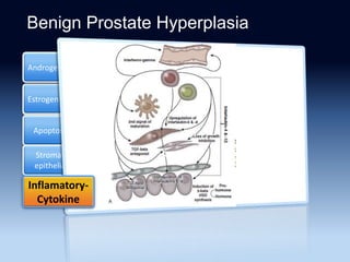 Etiology of BPH | PPT
