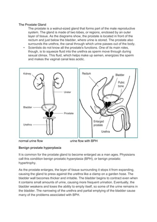 Bph presentation | PDF