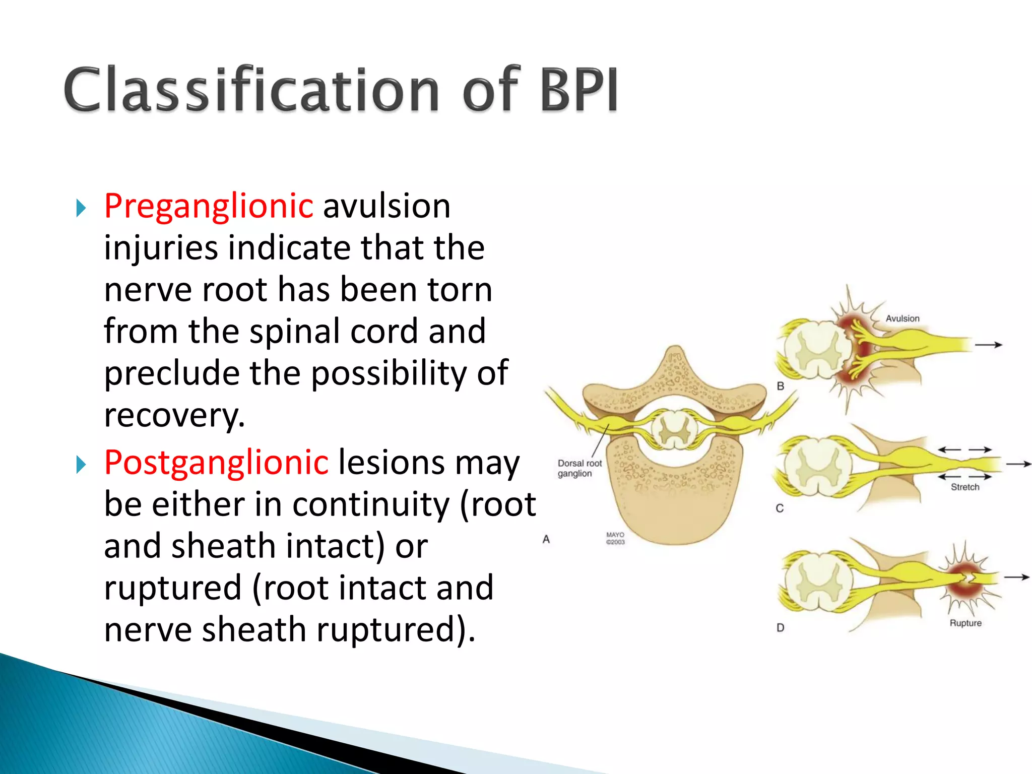 BRACHIAL PLEXUS INJURY: EVALUATION AND MANAGEMENT | PDF