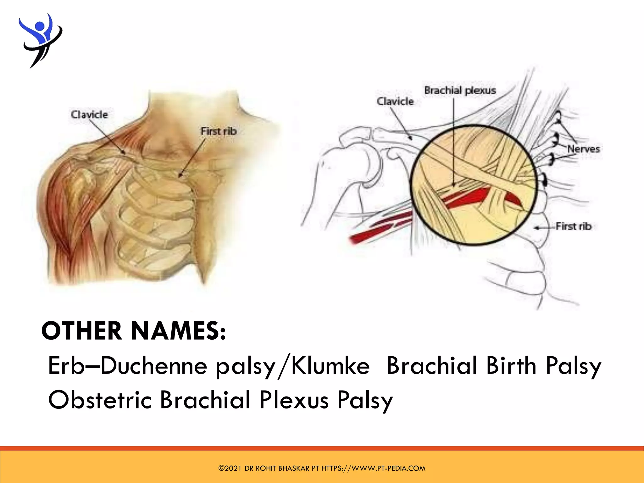 BRACHIAL PLEXUS INJURY - Dr Rohit Bhaskar | PDF