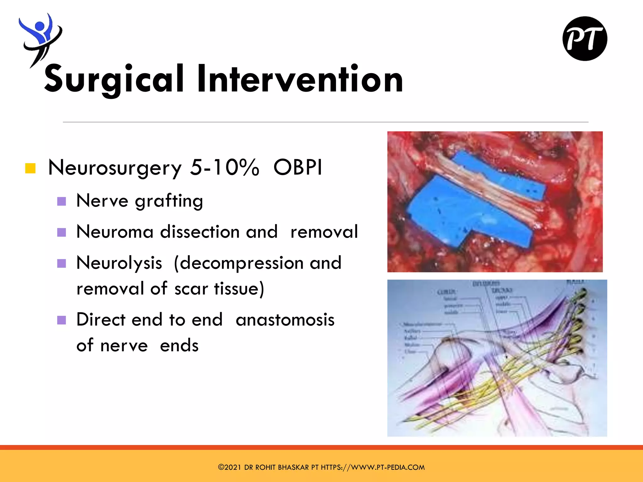 BRACHIAL PLEXUS INJURY - Dr Rohit Bhaskar | PDF