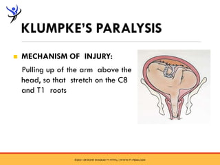 BRACHIAL PLEXUS INJURY - Dr Rohit Bhaskar | PDF