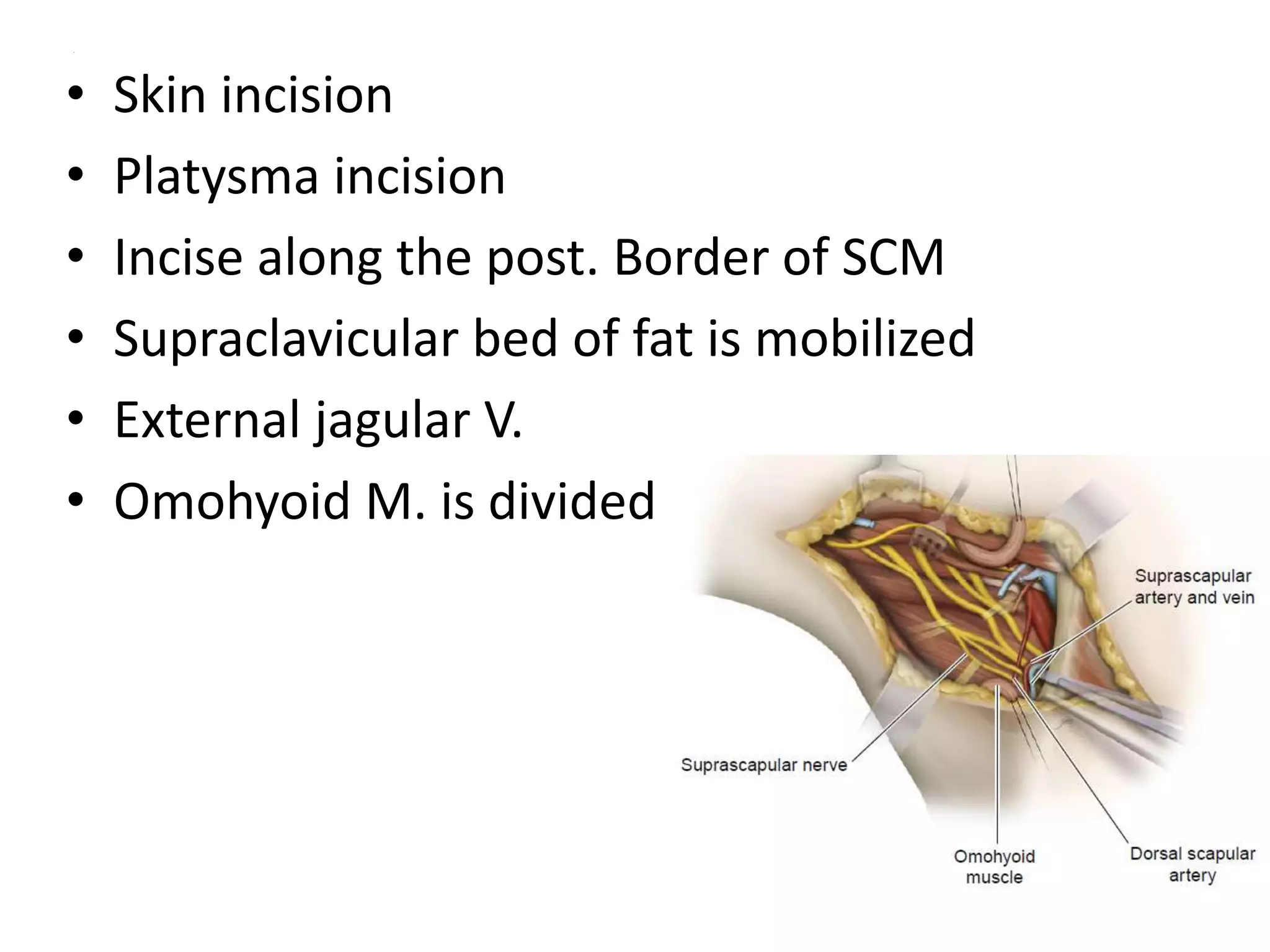 Brachial plexus surgery (simple introduction) | PPTX