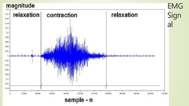 ELECTROMYOGRAM | PPT