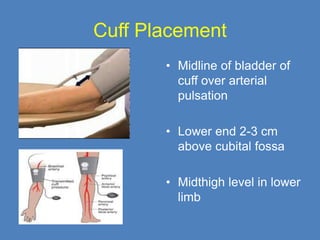Lower Extremity Blood Pressure Technique