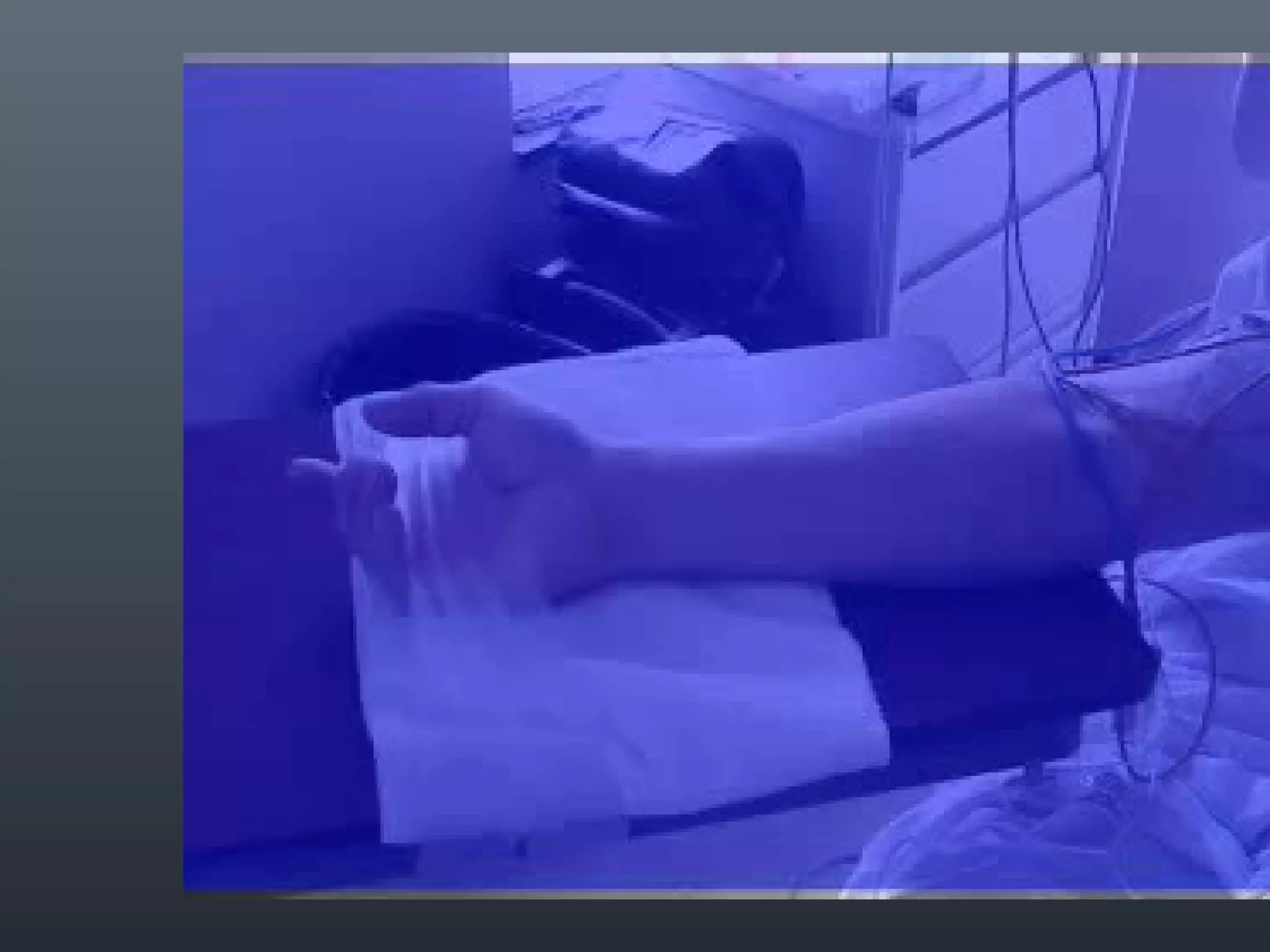 Non Invasive and Invasive Blood pressure monitoring RRT | PPT