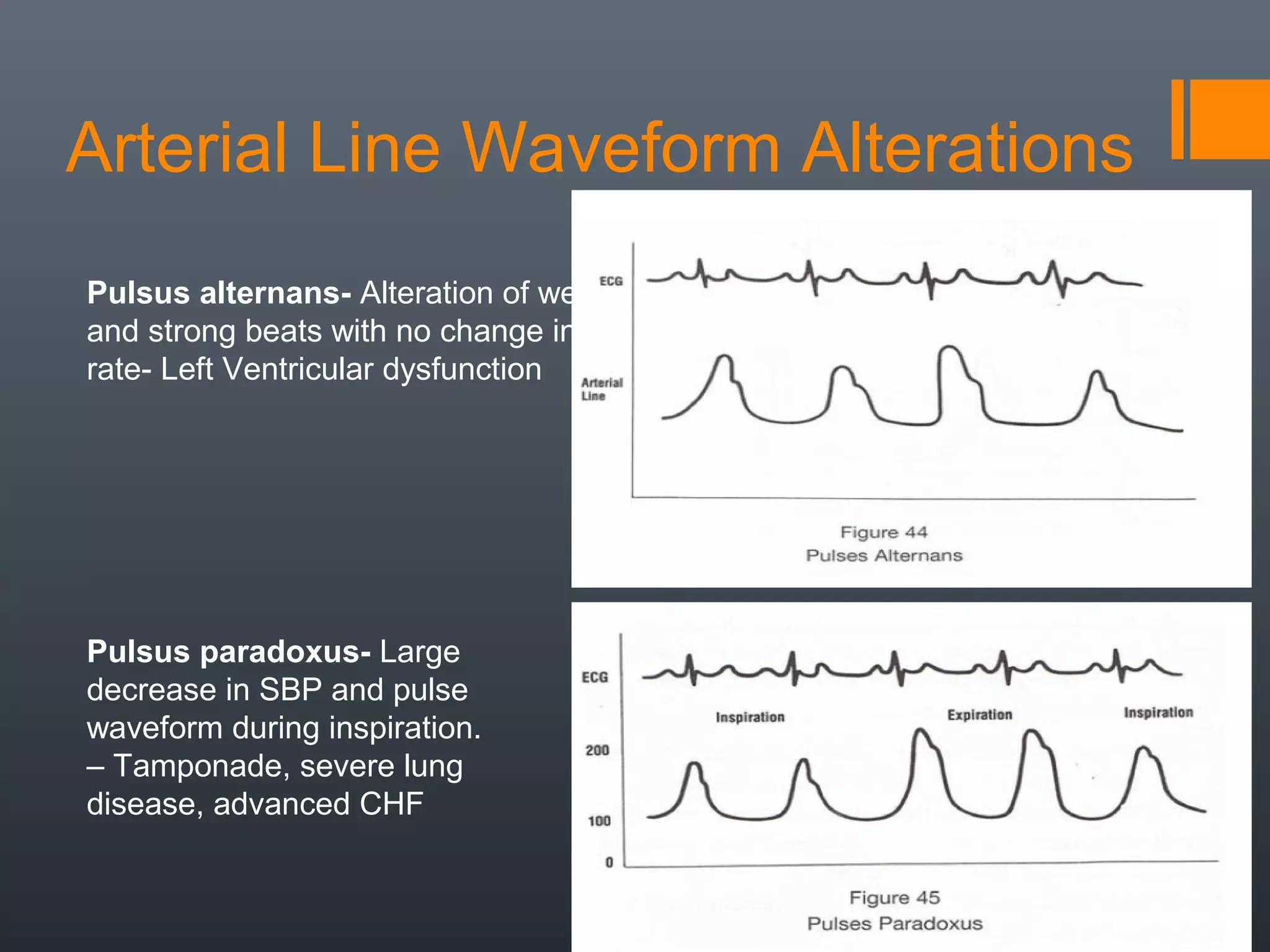 Non Invasive and Invasive Blood pressure monitoring RRT | PPT
