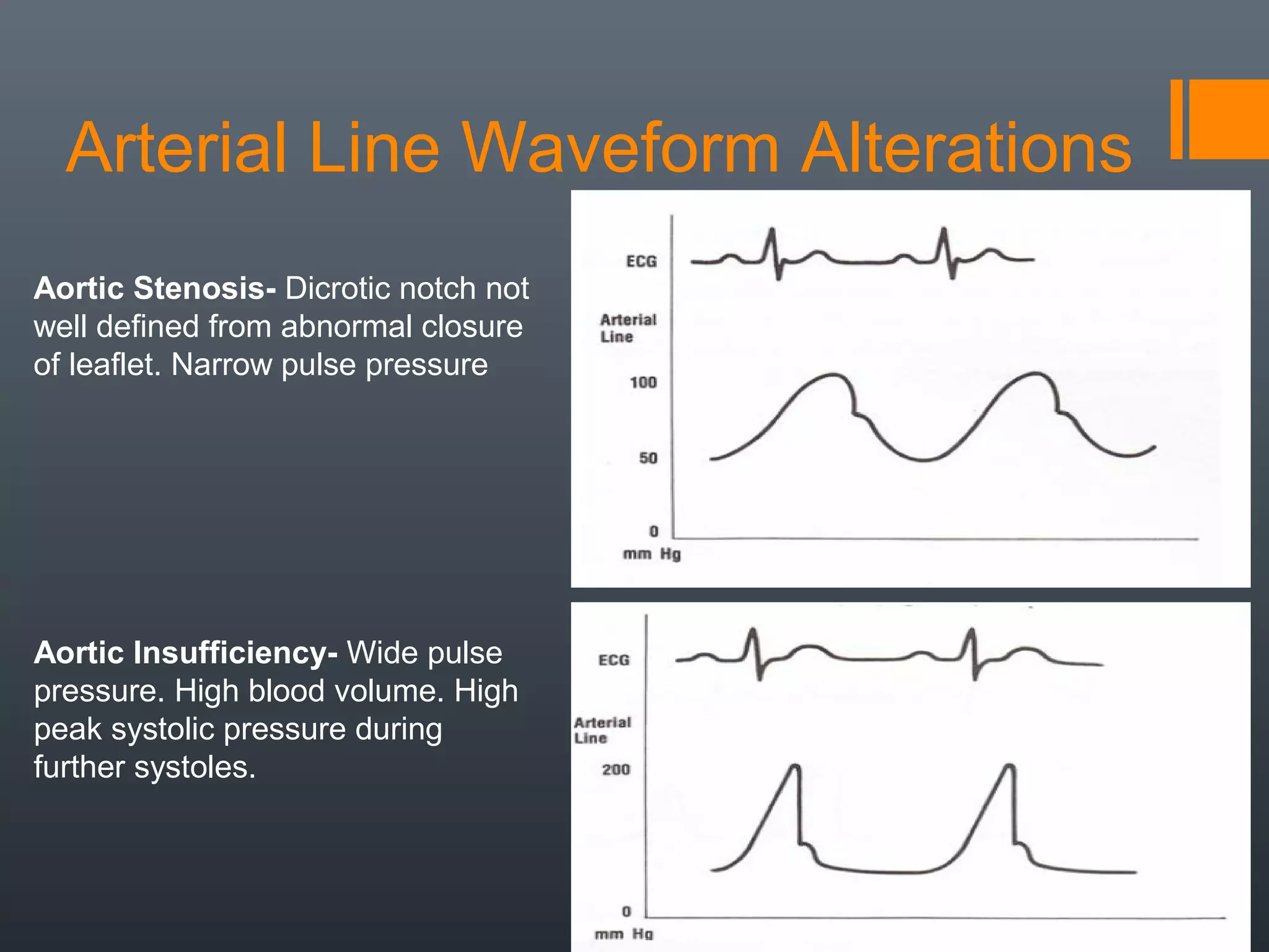 Non Invasive and Invasive Blood pressure monitoring RRT | PPT