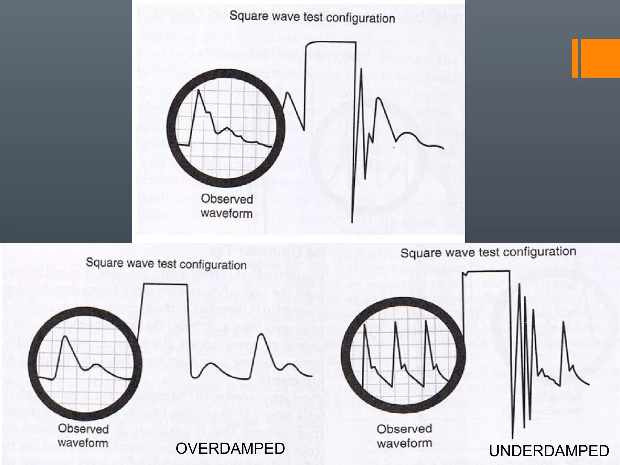 Non Invasive and Invasive Blood pressure monitoring RRT | PPT
