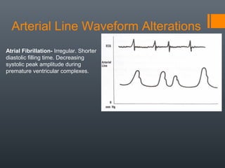 Non Invasive and Invasive Blood pressure monitoring RRT | PPT