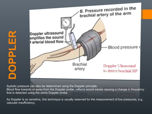 Non Invasive and Invasive Blood pressure monitoring RRT | PPT