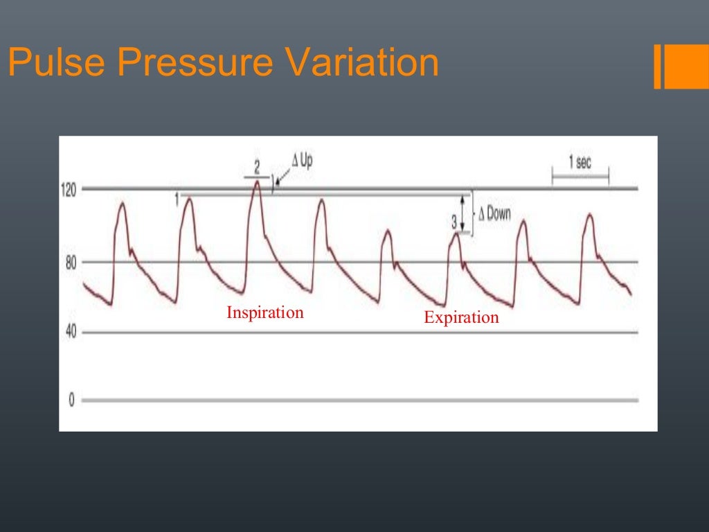 Non Invasive and Invasive Blood pressure monitoring RRT