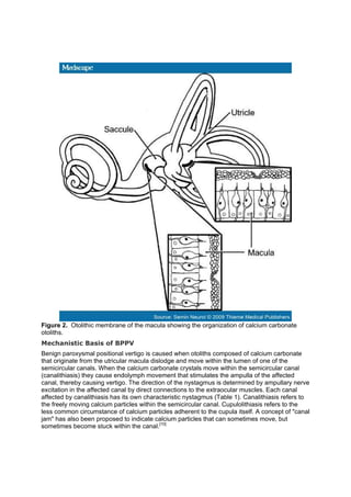 Bppv | PDF | Brain and Nervous System Disorders | Diseases and Conditions