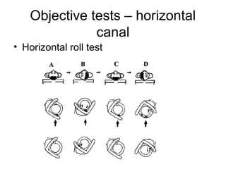 Vestibular assessment from the physiotherapy perspective | PPT