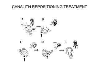 Vestibular assessment from the physiotherapy perspective | PPT