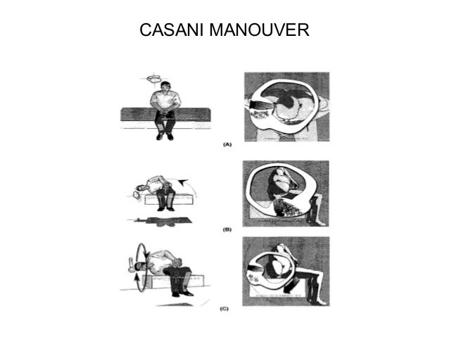 Vestibular assessment from the physiotherapy perspective